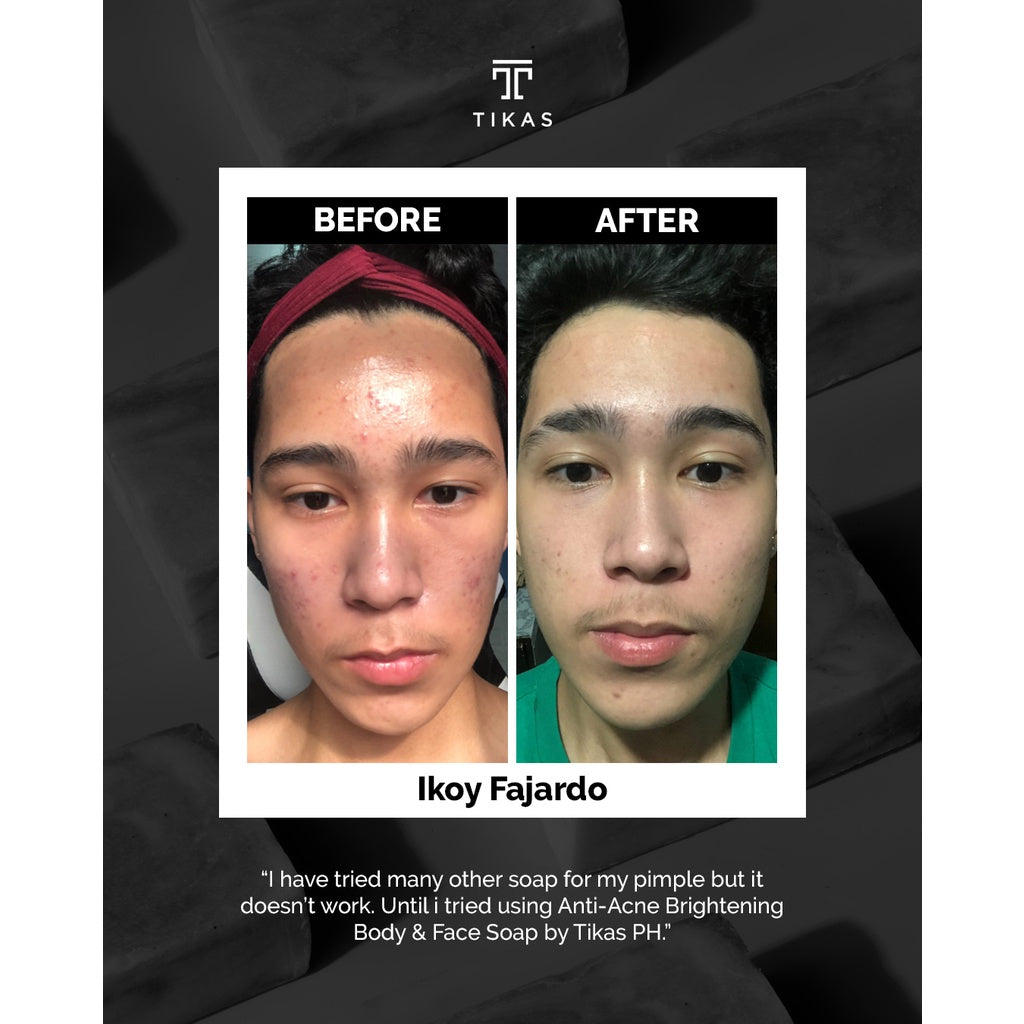 Tikas Niacinamide Body and Face Soap [Set of 2]